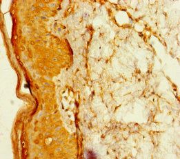 TADA2B Antibody | Biorbyt